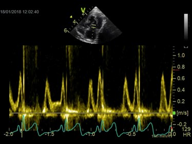 Post-course evaluation